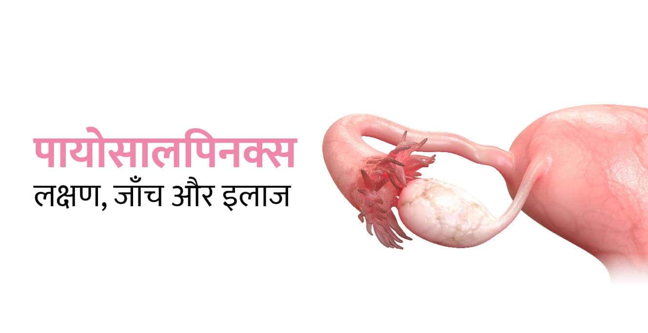 पायोसालपिनक्स क्या है? कारण, लक्षण, निदान और उपचार
