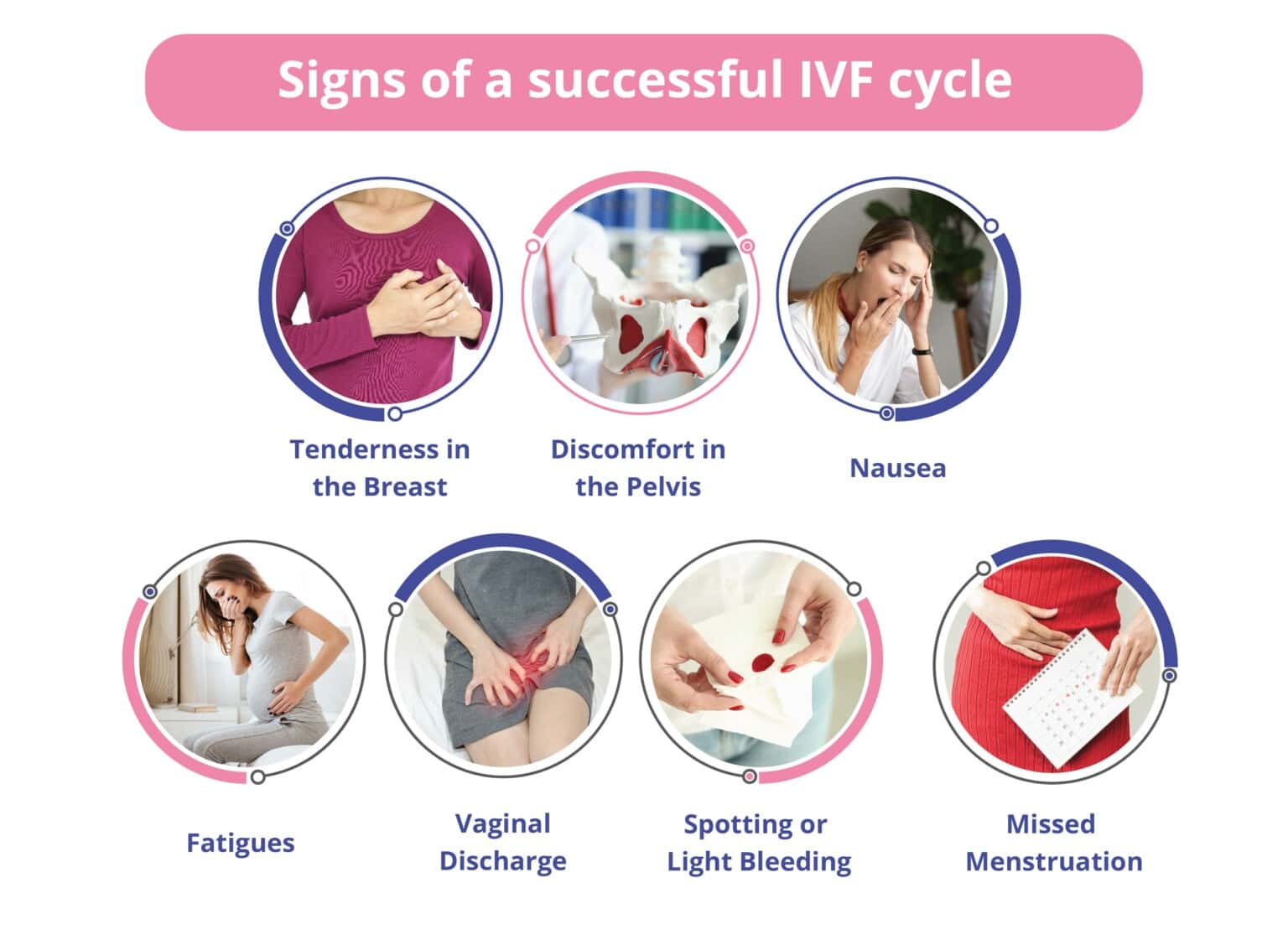 IVF (In Vitro Fertilization): Procedure, Treatment, Do's & Don'ts